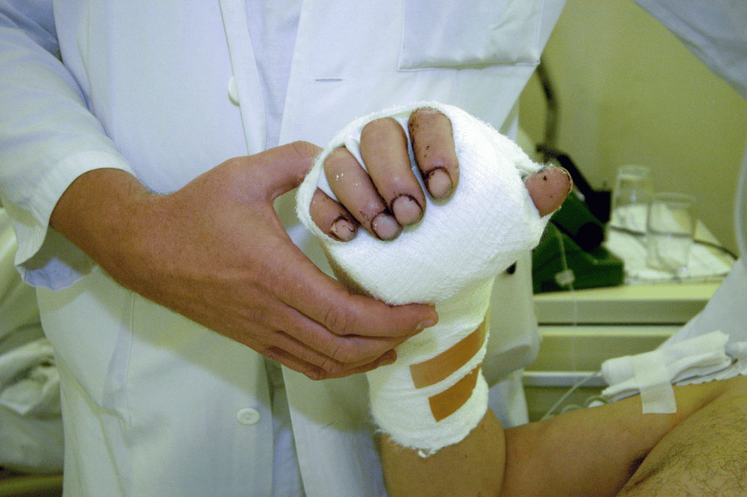 Hand-Safety at Product Transitions: What Bulk Processing Plants Need To ...